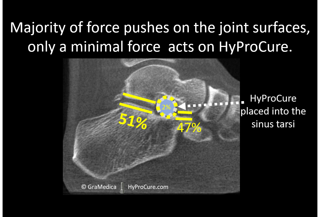 How Does it Work? - GraMedica