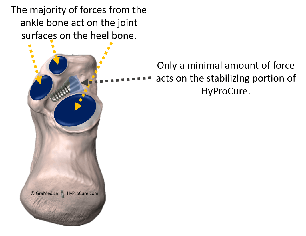 How Does it Work? - GraMedica